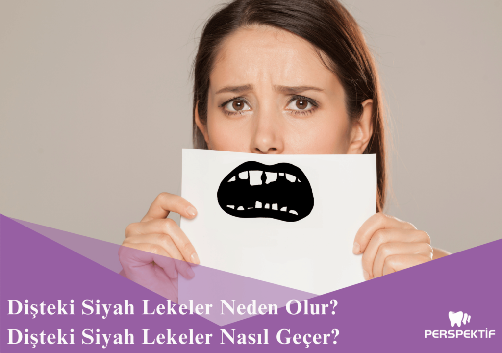 Dişteki Siyah Lekeler Neden Olur, Nasıl Geçer? - Perspektif Ağız ve Diş ...